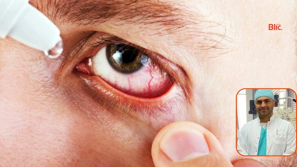 Infeksionet e syrit: Simptomat, shkaqet dhe trajtimi efektiv ...